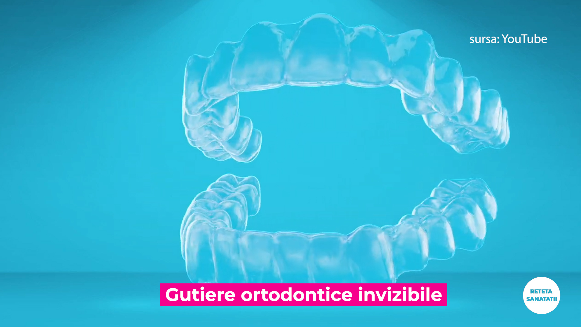 GUTIERE ORTODONTICE INVIZIBILE - THE VISION