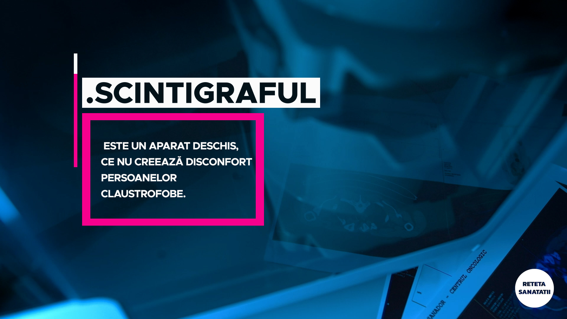 CE ESTE SCINTIGRAFIA DE CORD? - THE VISION