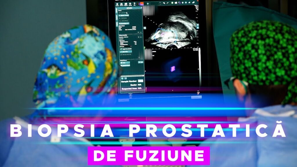 BIOPSIA PROSTATICĂ DE FUZIUNE | TheVision.ro
